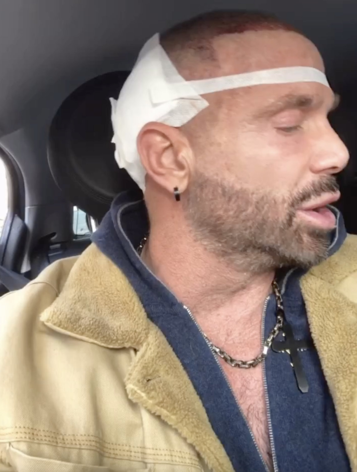 ''Dolori insopportabili e 10 ore di intervento'': Alex Nuccetelli si è ...