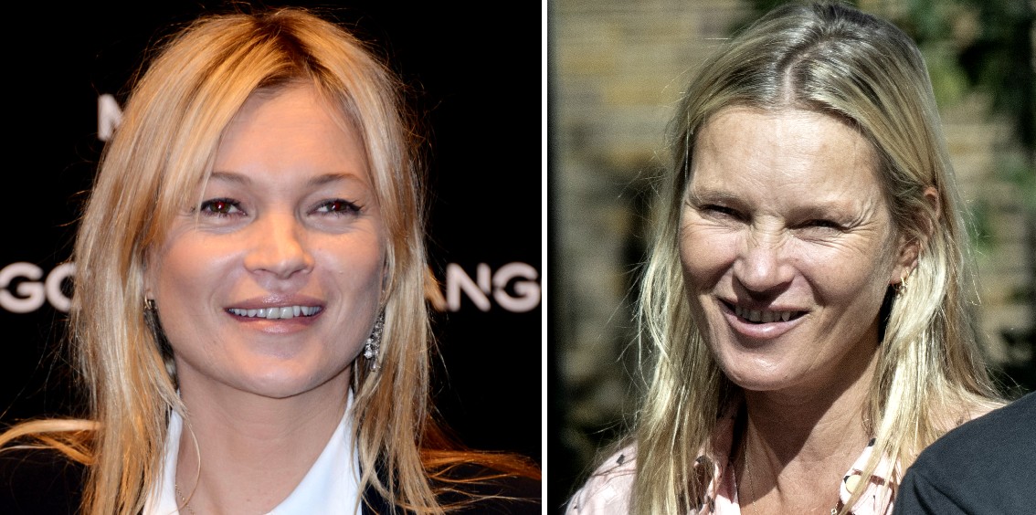 A quasi 50 anni Kate Moss inizia a mostrare i segni del tempo: lo ...