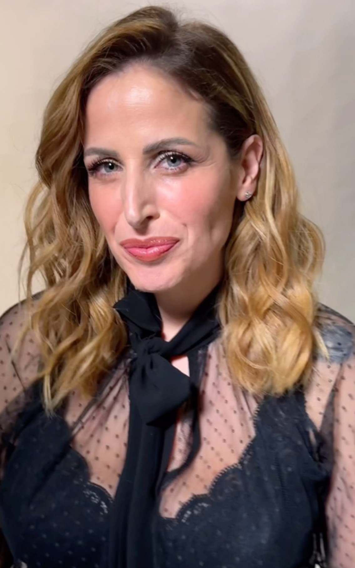 Clio MakeUp mostra gli occhi dopo aver rimosso i punti della ...